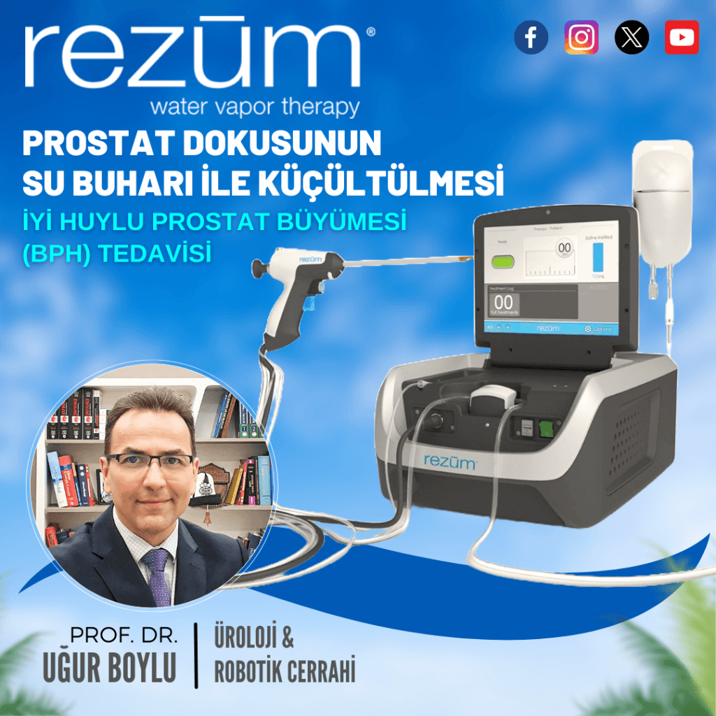 REZUM: İyi Huylu Prostat Büyümesi (BPH) tedavisinde yeni tedavi! | PROF ...